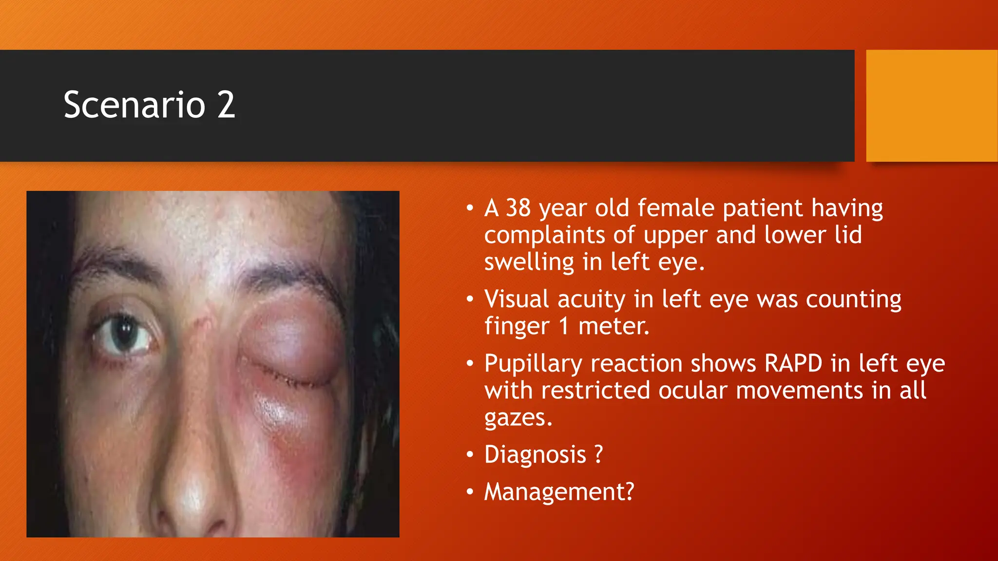 Case based scenarios orbit- orbital cellulitis | PPTX