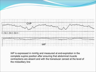 Case Based teaching IAH.ppt