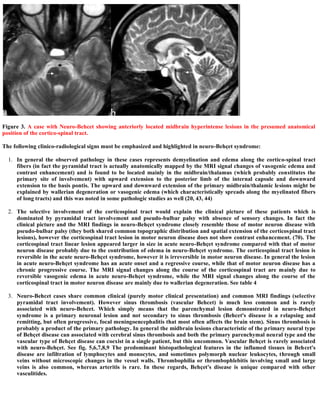 Case record...Neuro-Behcet | PDF | Brain and Nervous System Disorders ...