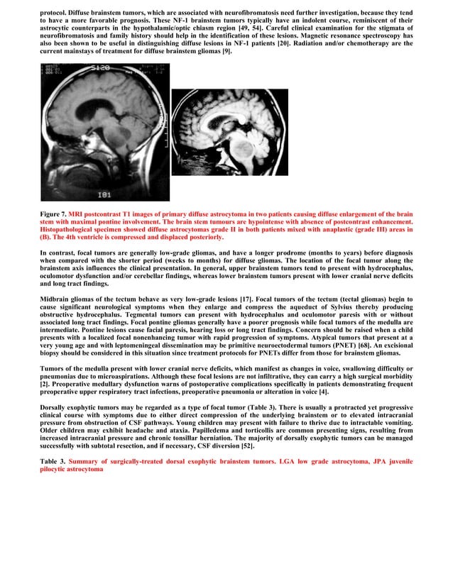 Case record...brain stem glioma | PDF