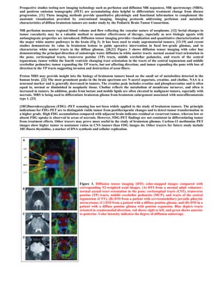 Case record...Tectal plate glioma | PDF