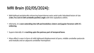 FSRT Fractionated Radiotherapy in Schwannoma | PPTX | Cancer | Diseases ...