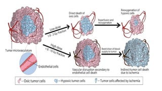 FSRT Fractionated Radiotherapy in Schwannoma | PPTX | Cancer | Diseases ...