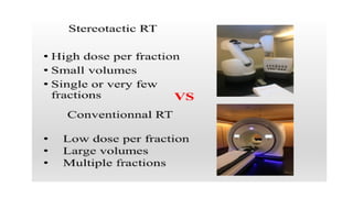 FSRT Fractionated Radiotherapy in Schwannoma | PPTX | Cancer | Diseases ...