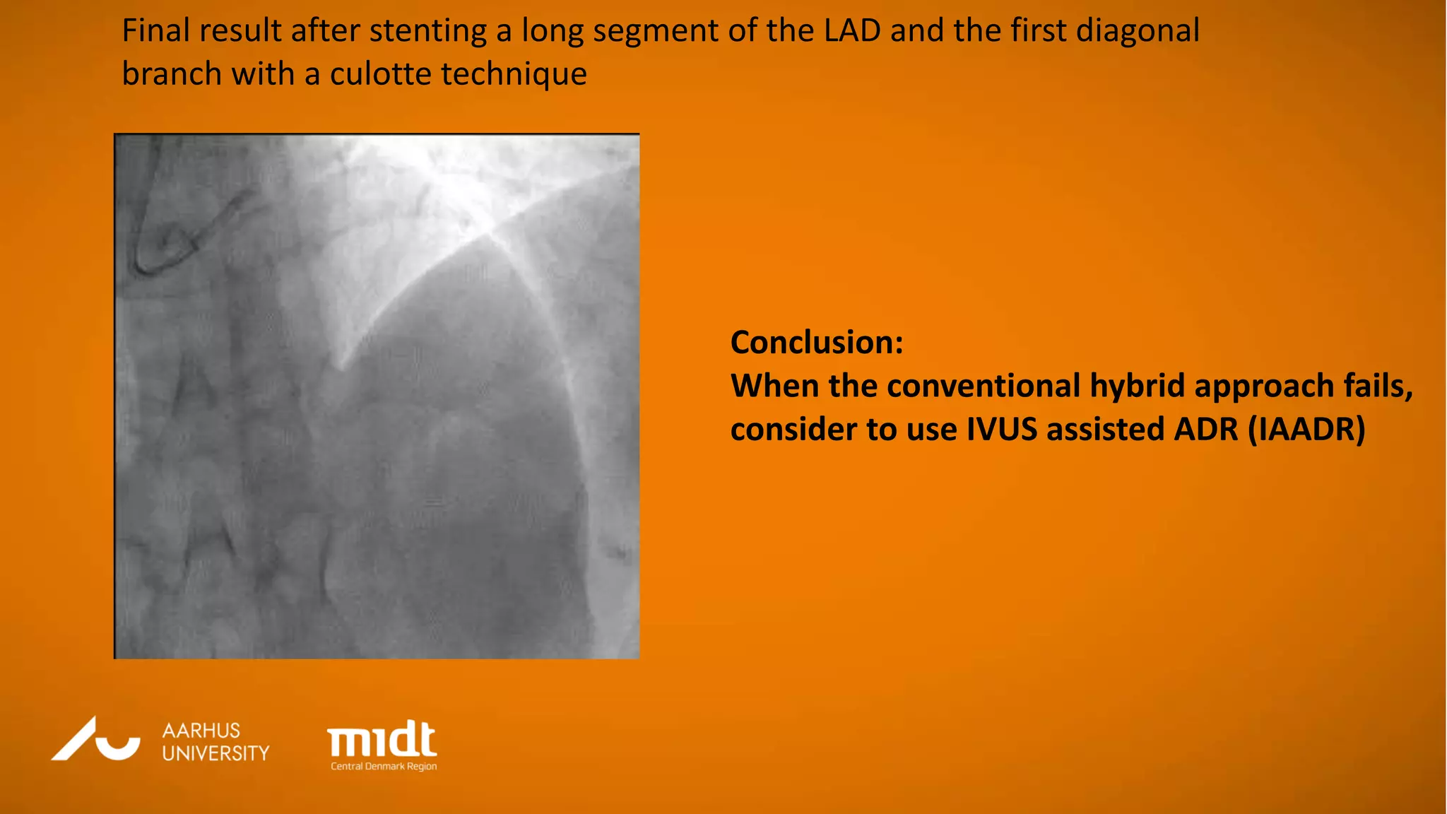 IVUS assisted antegrade dissection and re entry (IAADR) | PPT