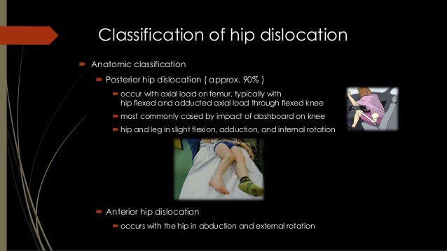 Hip dislocation