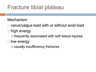 Tibial plateau fracture | PPTX