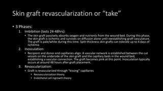 Case conference - STSG over integra.pptx