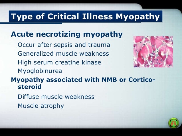 Chronic Illness Polyneuromyopathy/ Myopathy