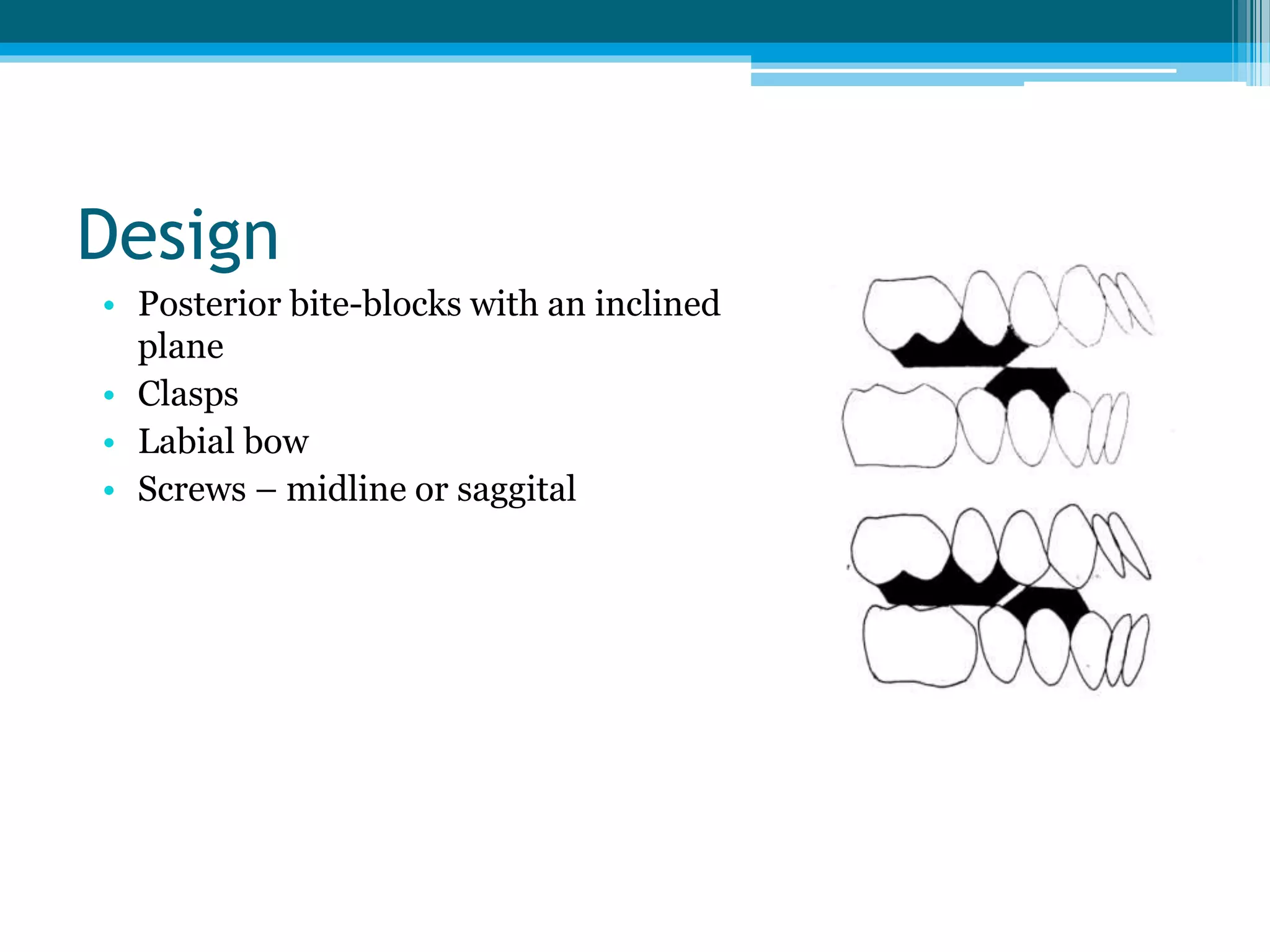 The Twin Block Appliance | PPTX