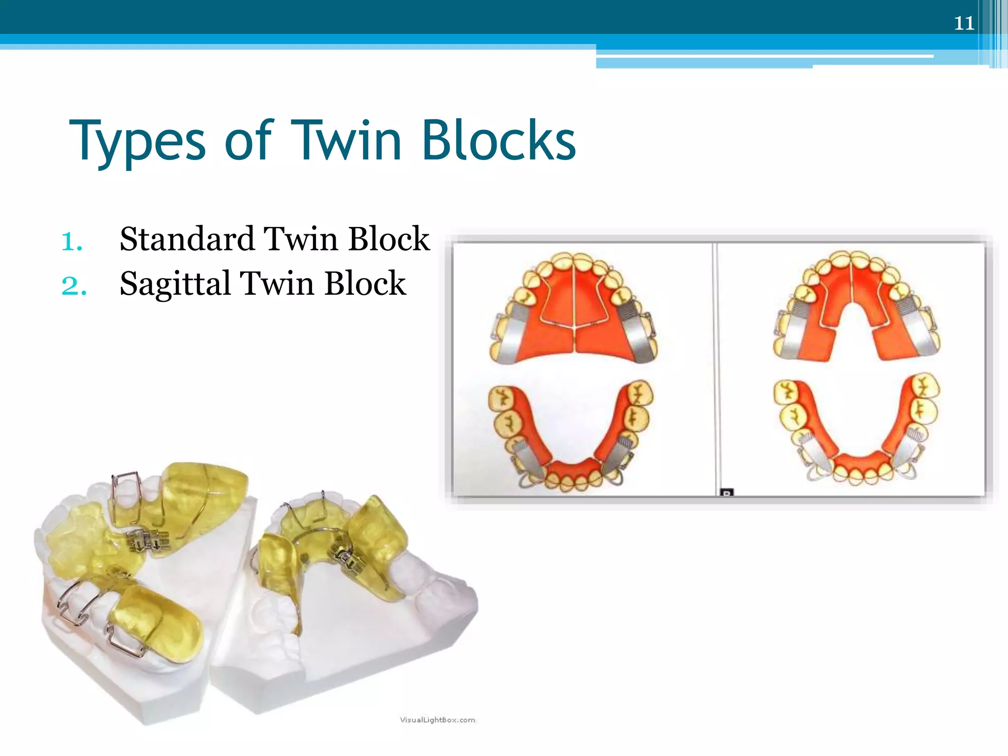 The Twin Block Appliance | PPTX | Dental Health | Diseases and Conditions