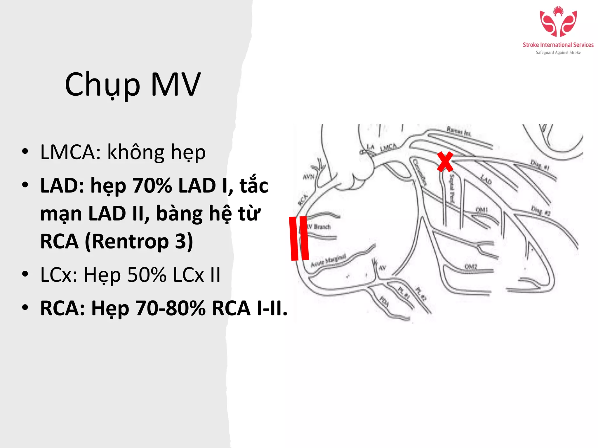 CASE CTO- NGUYEN MANH CUONG.pptx