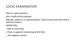 CASE DISCUSSION- Chronic Kidney Disease.pptx
