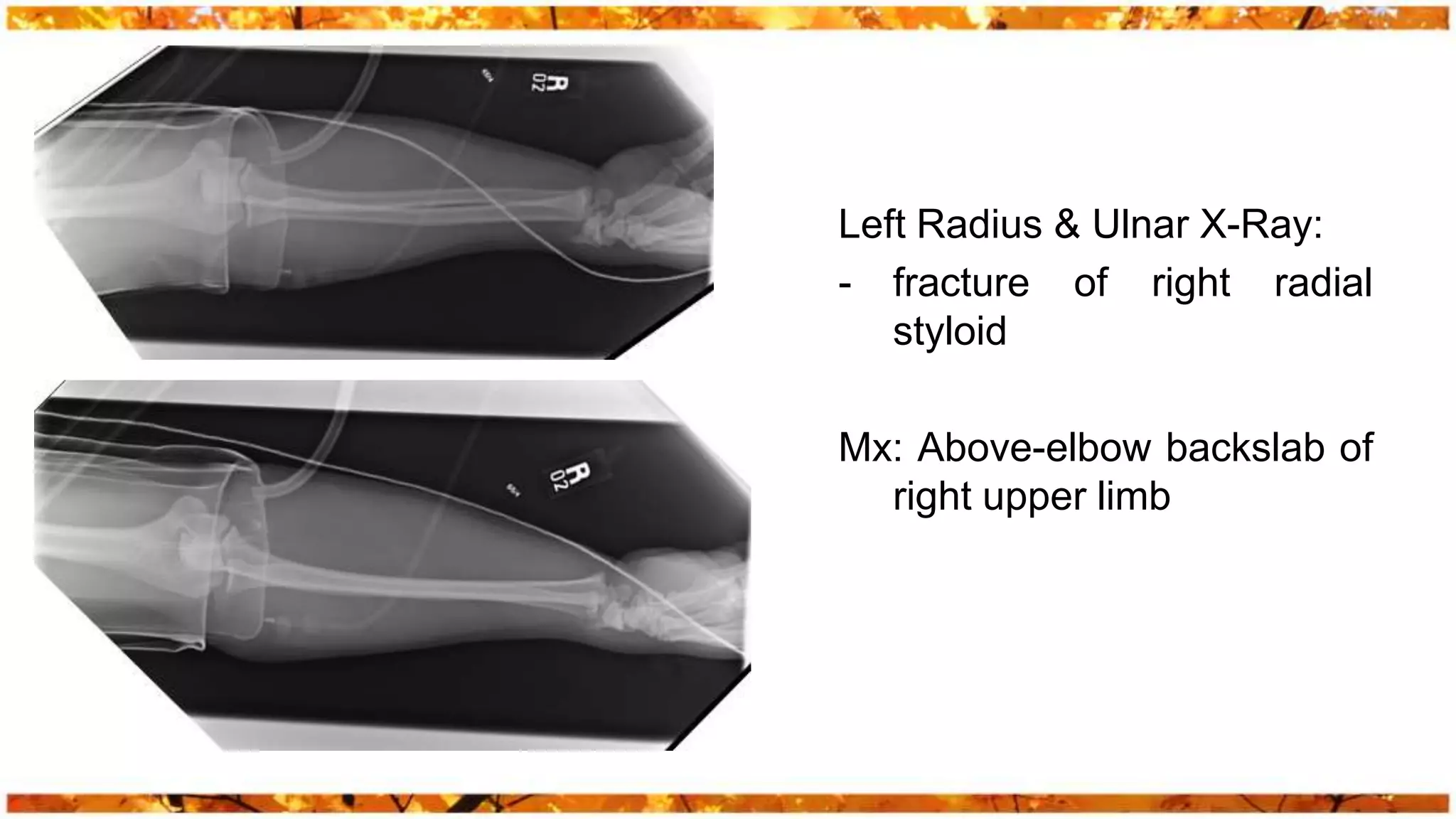 ED Case Discussion - Trauma (reviewed) | PPTX