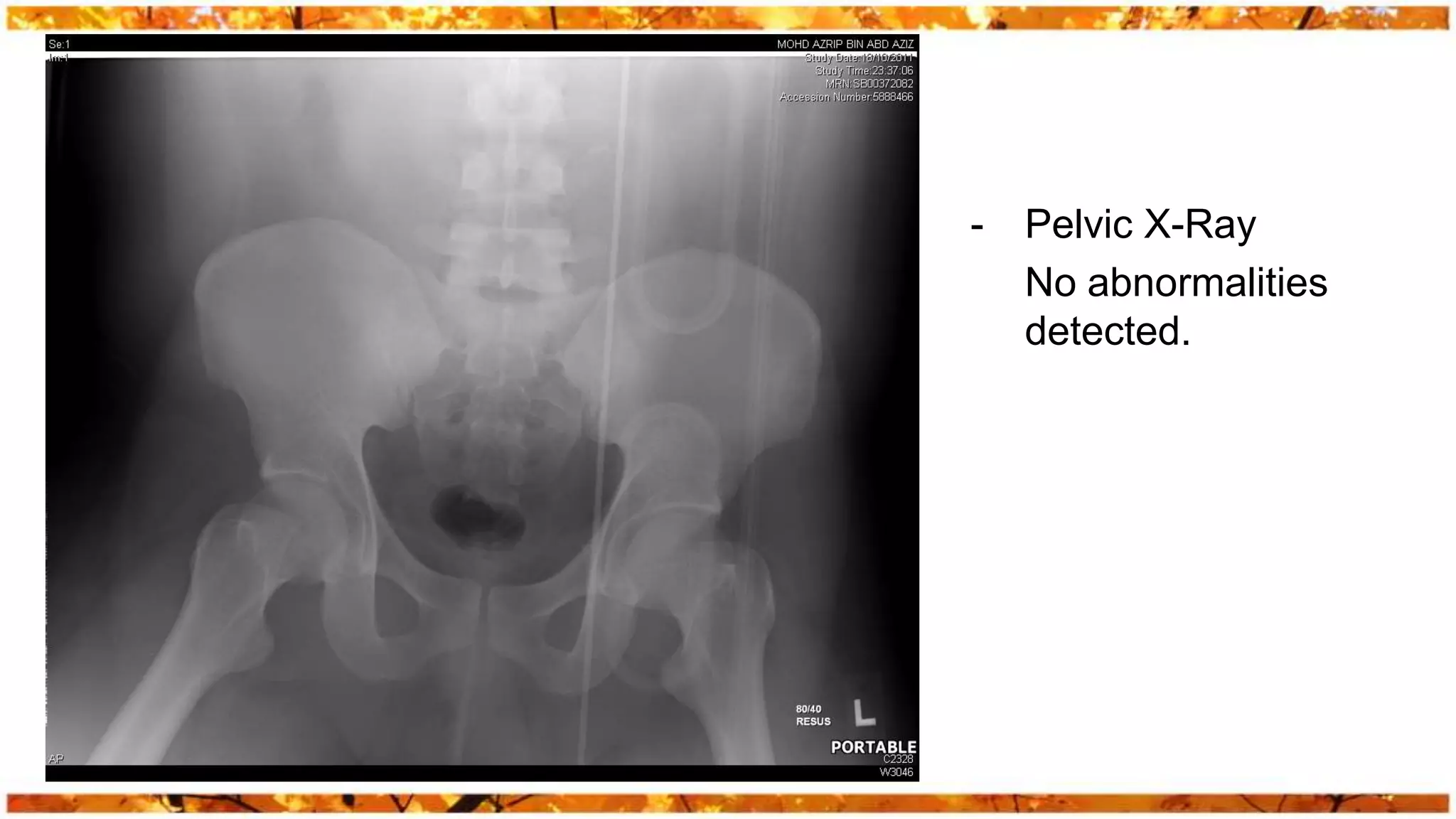 ED Case Discussion - Trauma (reviewed) | PPTX