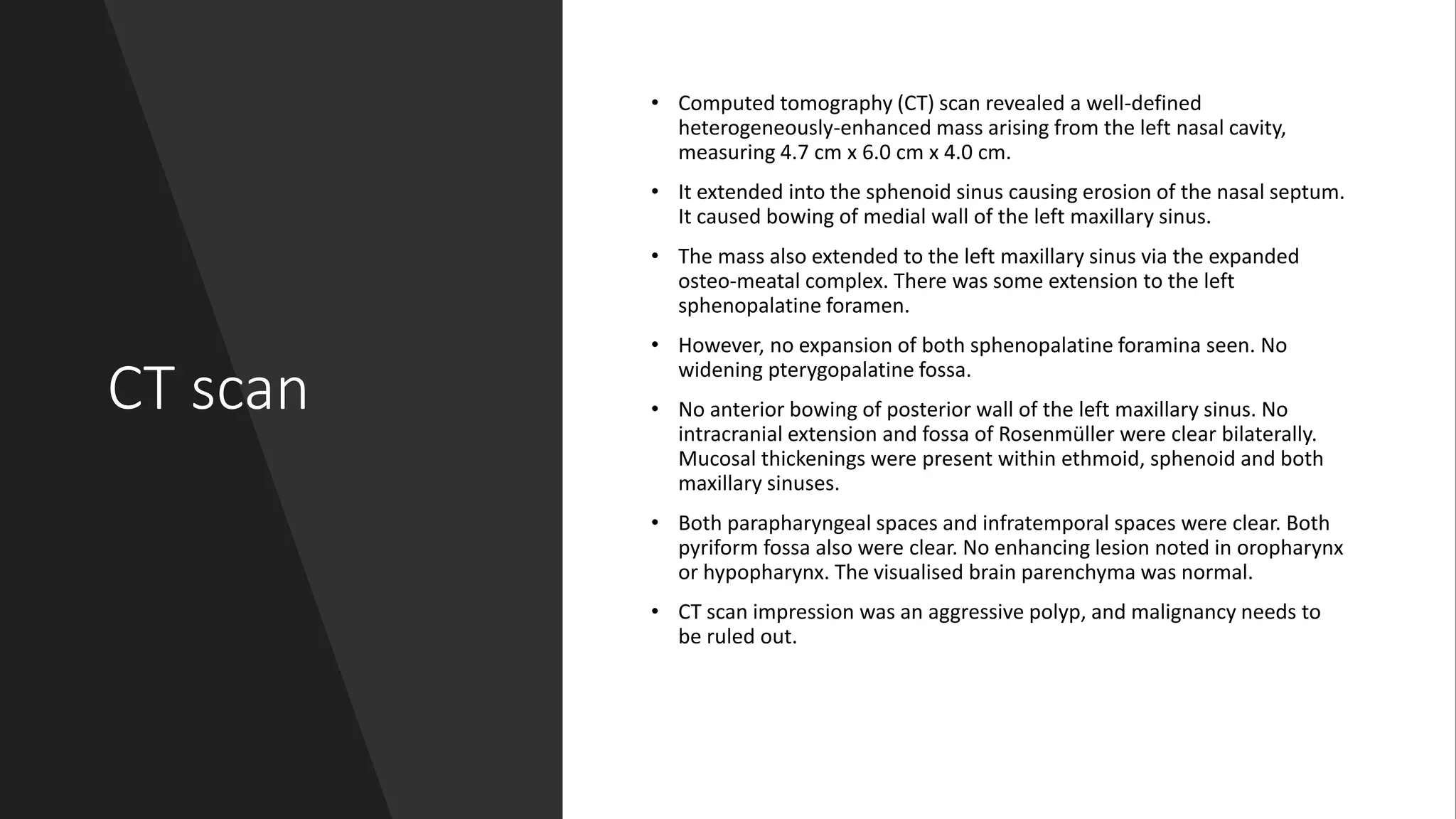 Juvenile nasopharyngeal angiofibroma (JNA) - Case discussion | PPT