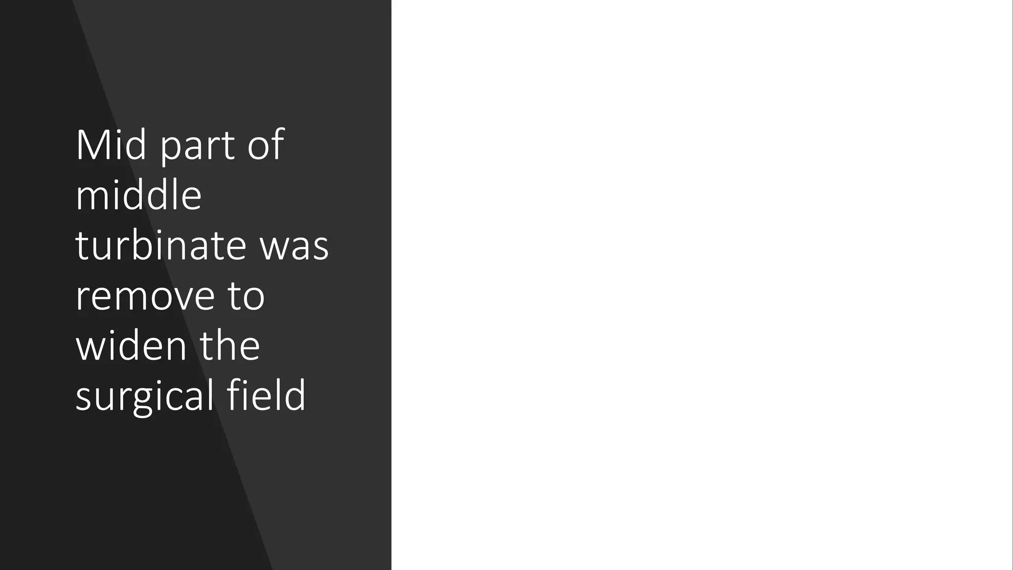 Juvenile nasopharyngeal angiofibroma (JNA) - Case discussion | PPT