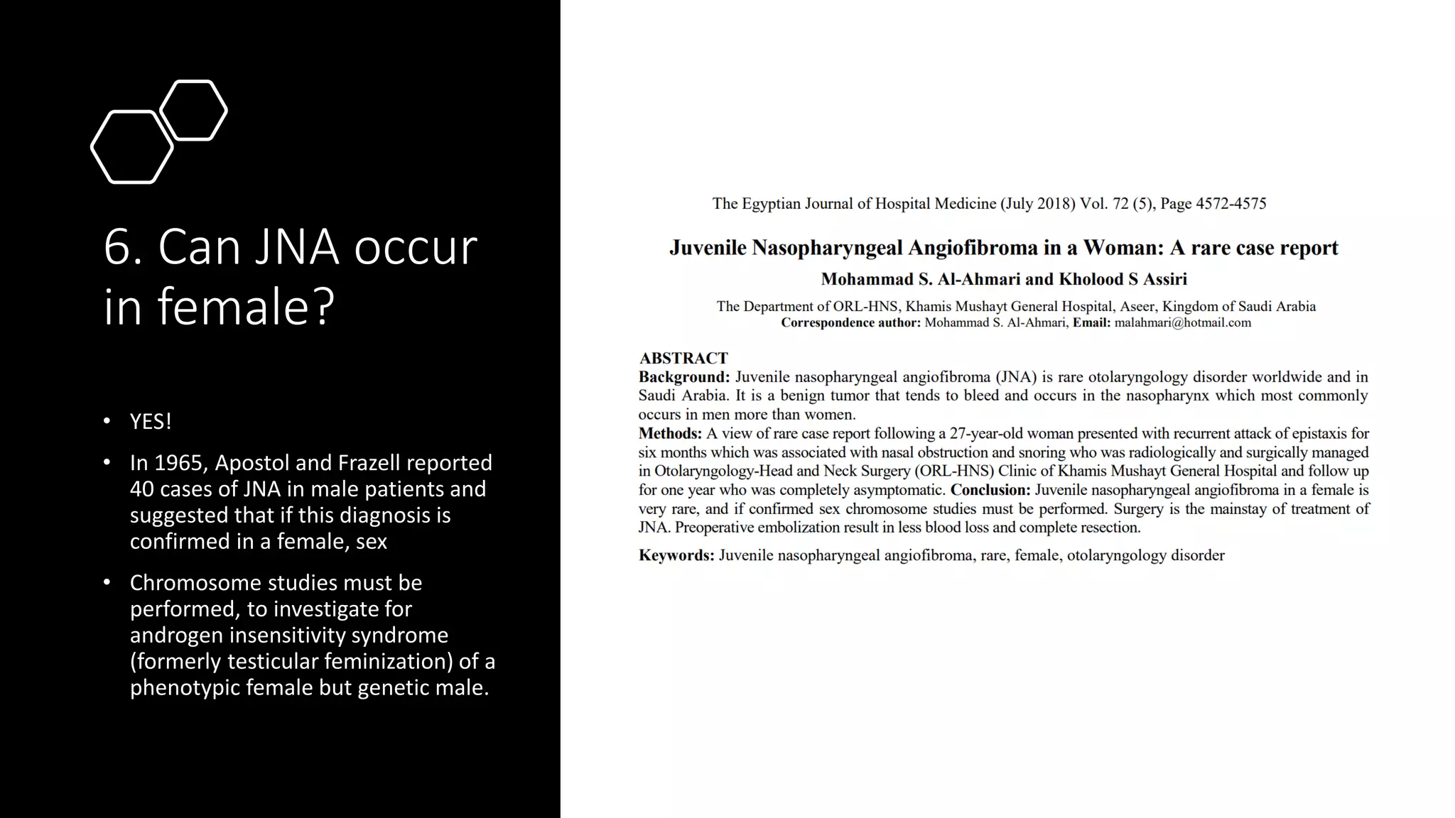 Juvenile nasopharyngeal angiofibroma (JNA) - Case discussion | PPT