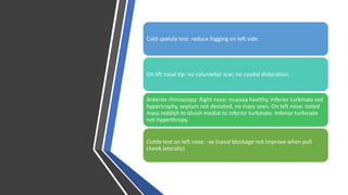 Juvenile nasopharyngeal angiofibroma (JNA) - Case discussion | PDF