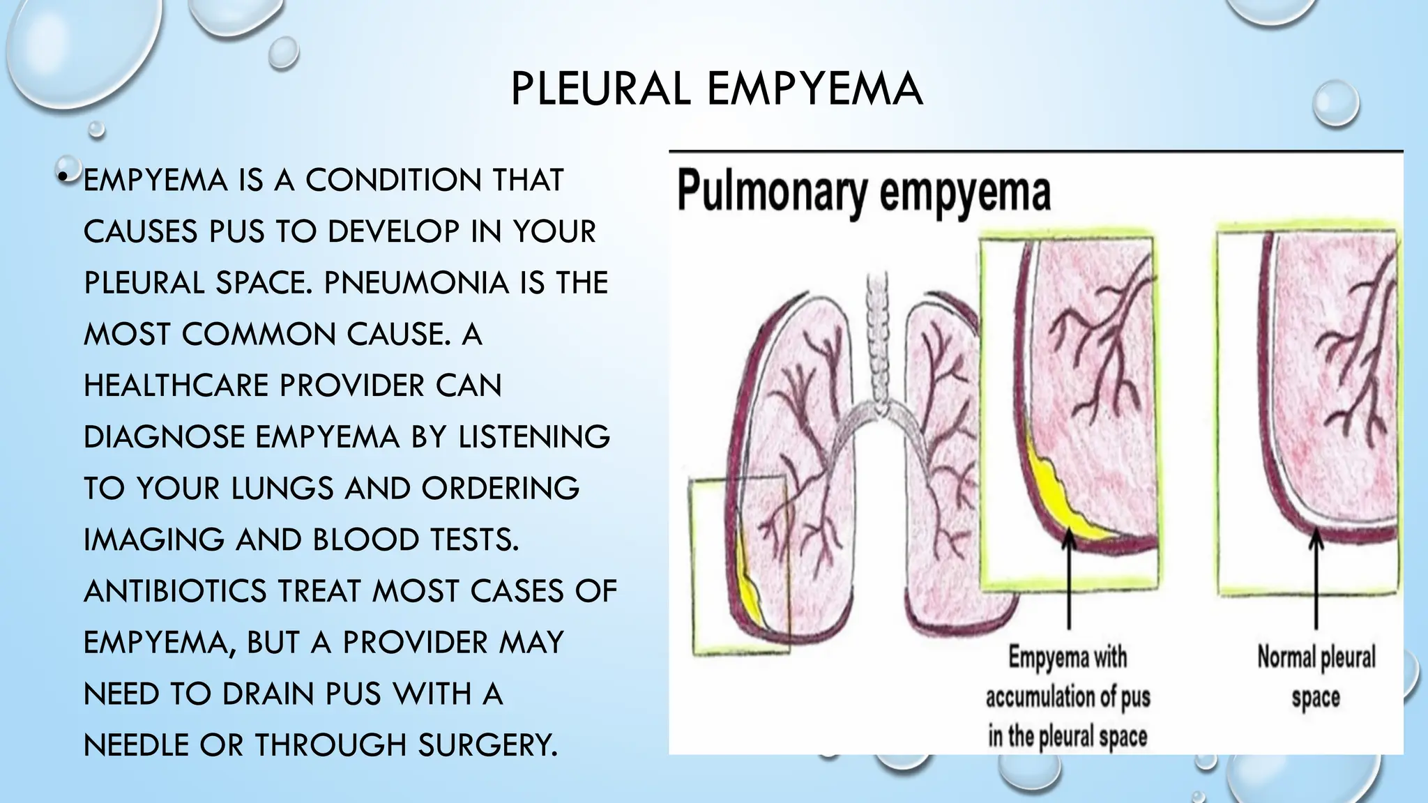 CASE DISCUSSION Pleural Emphyma & Lungs Abcess.pptx