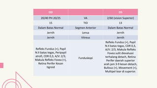 Case Discussion Retinal Detachment (1).pptx