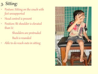 Case presentation- A Pediatric Neurological case..!! | PPT