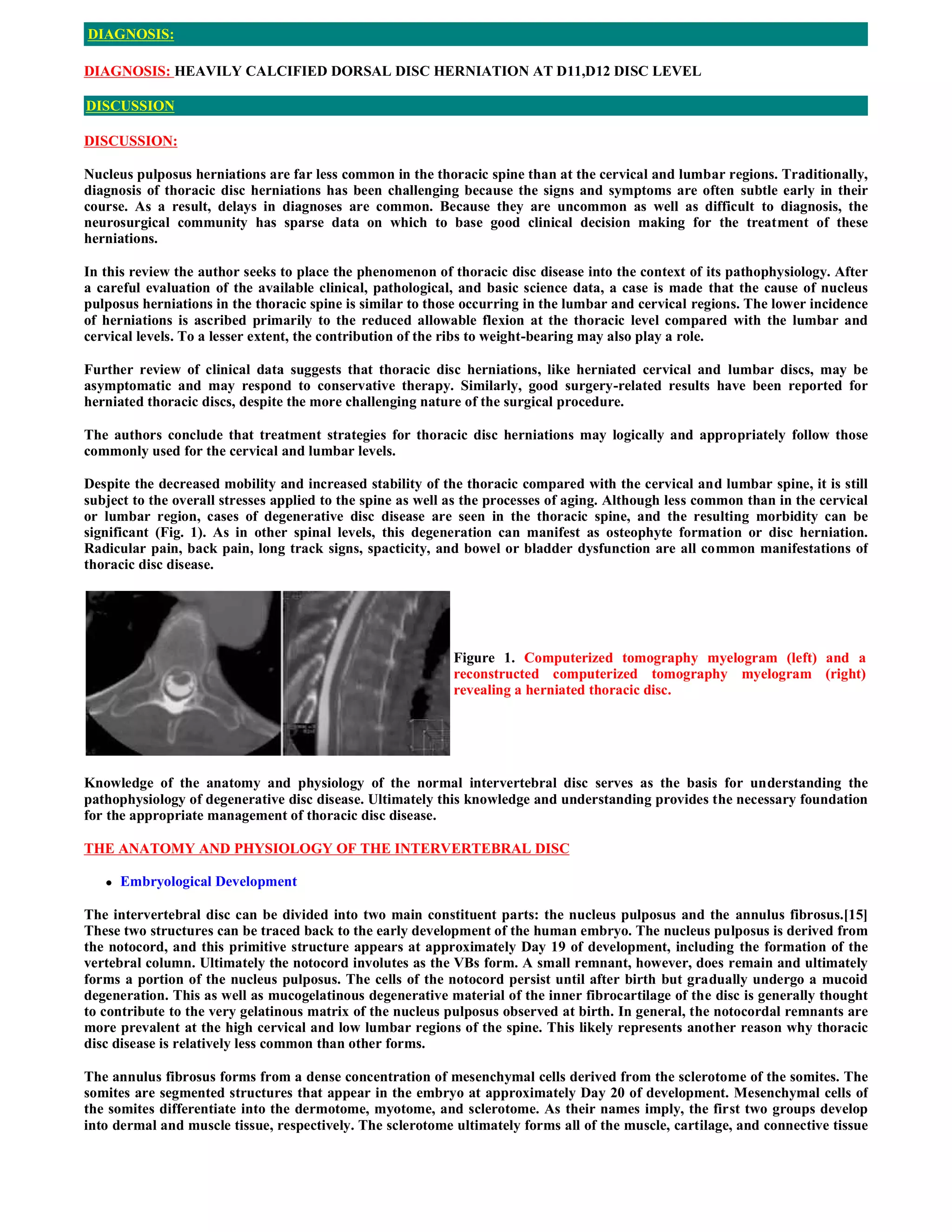 case record...Heavily calcified dorsal disc herniation at D11,D2 disc ...