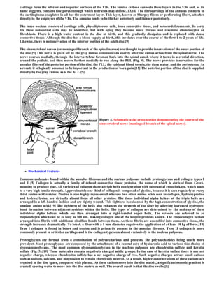 case record...Heavily calcified dorsal disc herniation at D11,D2 disc ...