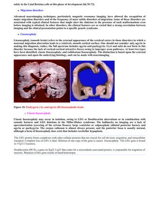 Case record...Cortical dysplasia | PDF