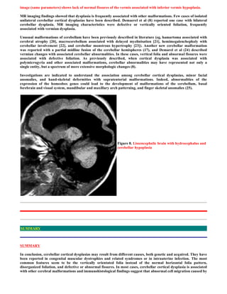 Case record...Cortical/cerebellar dysplasia | PDF | Brain and Nervous ...