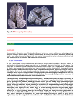 Case record...Cortical dysplasia | PDF | Brain and Nervous System ...