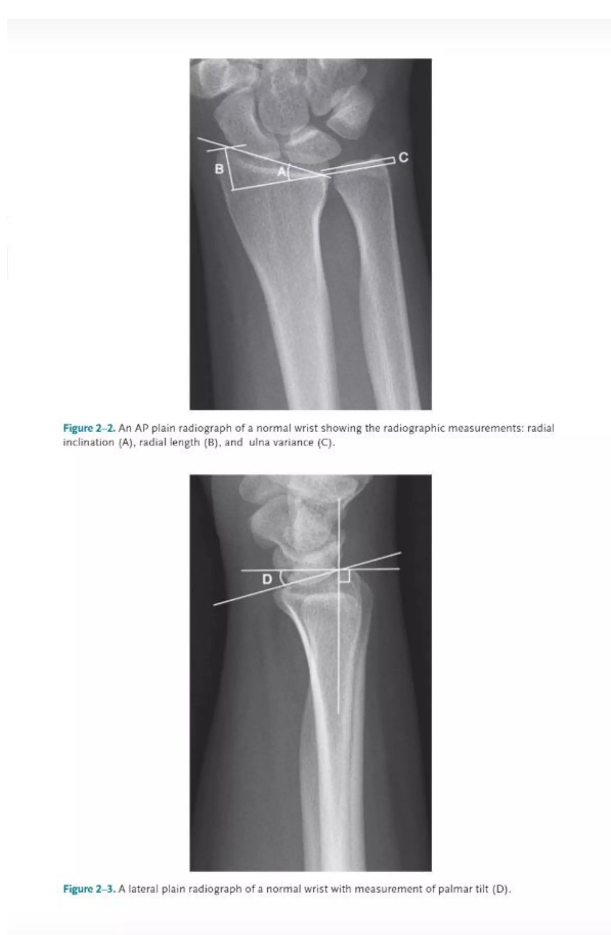 TOP 10 EXAMPLES CASE FILES (ORTHOPAEDIC SURGERY).pdf