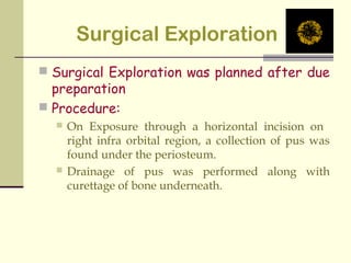 Case fungal osteomyelitis. | PPT
