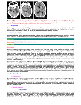 Case record...Herpes simplex type 1 encephalitis | PDF