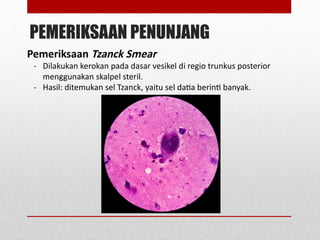 Diskusi Kasus Koas Herpes Zoster Case Report | PPT