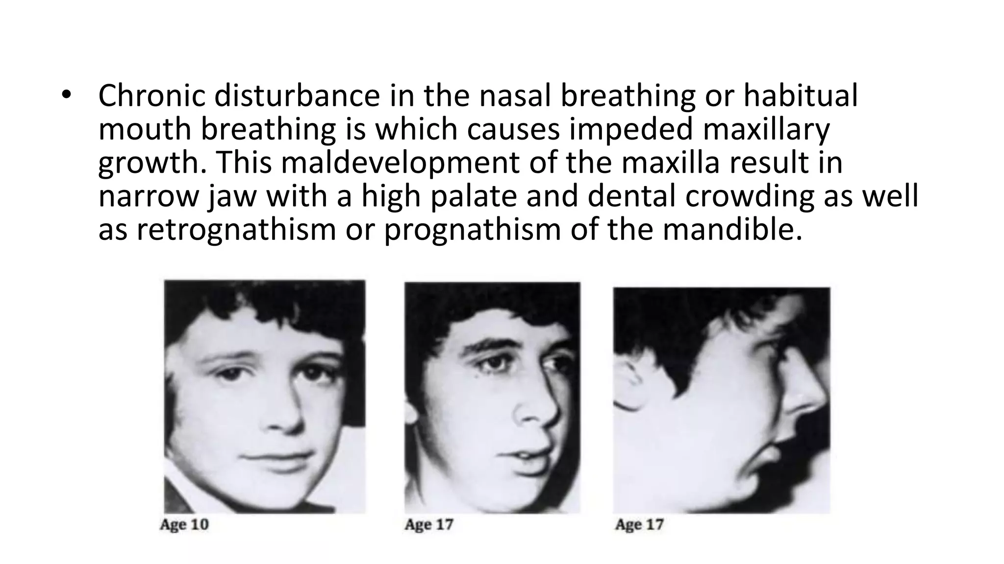 CASE HISTORY AND EXAMINATION IN ORTHODONTICS | PPTX