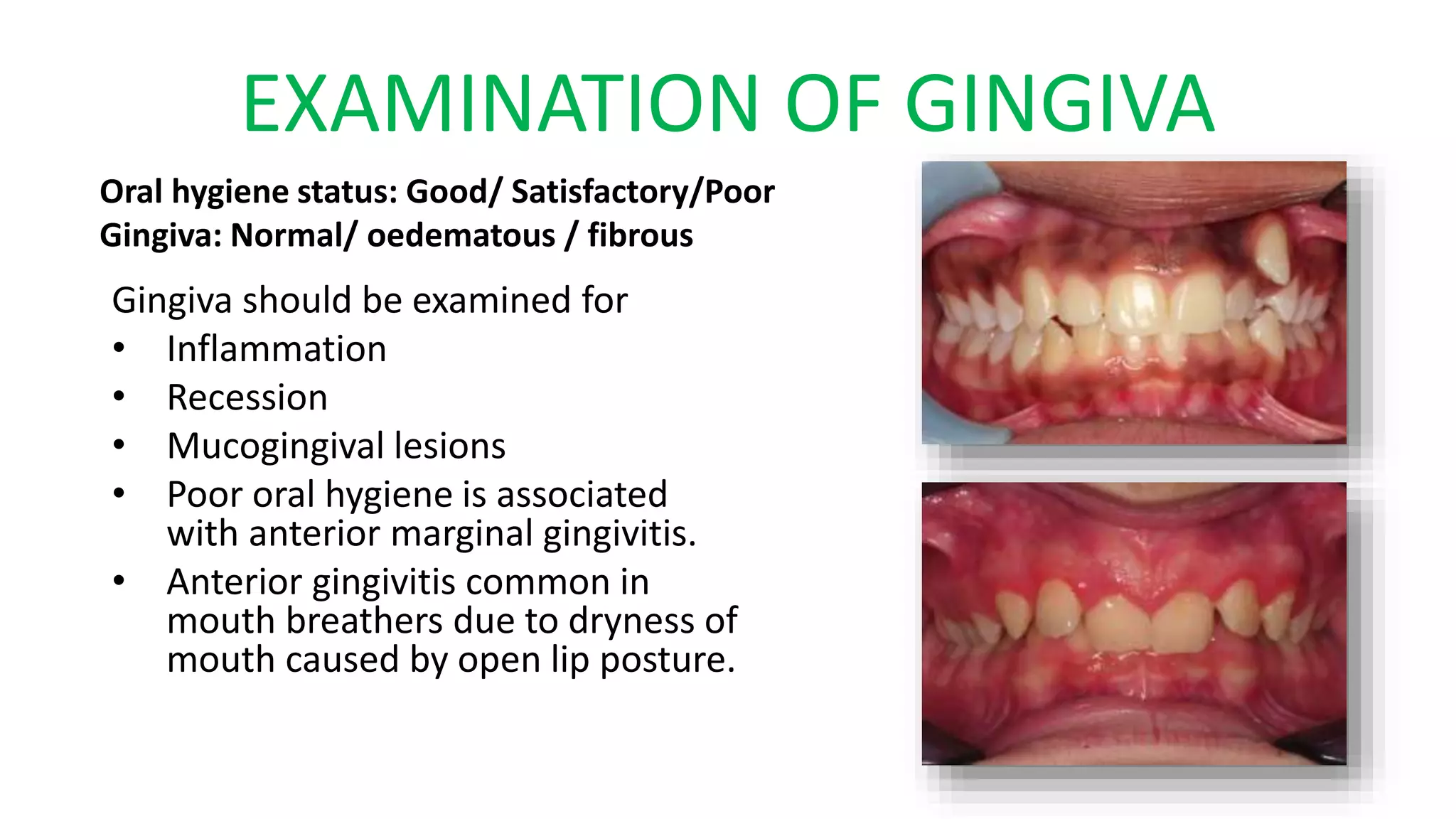 CASE HISTORY AND EXAMINATION IN ORTHODONTICS | PPTX