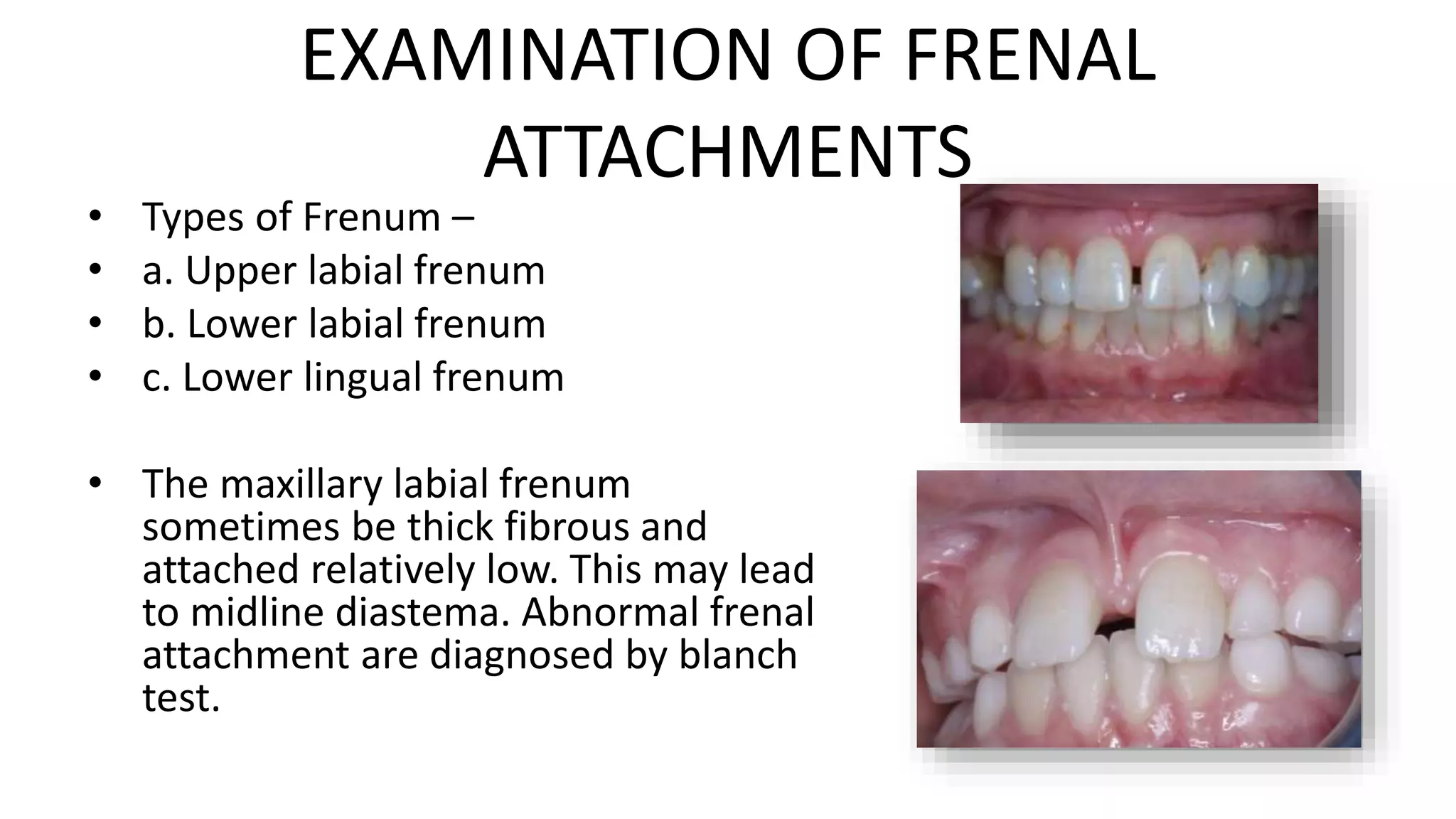 CASE HISTORY AND EXAMINATION IN ORTHODONTICS | PPTX