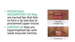 CASE HISTORY AND EXAMINATION IN ORTHODONTICS | PPTX