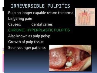 CASE HISTORY IN ENDODONTICS.pptx