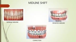 Case history pedodontics | PPTX | Dental Health | Diseases and Conditions