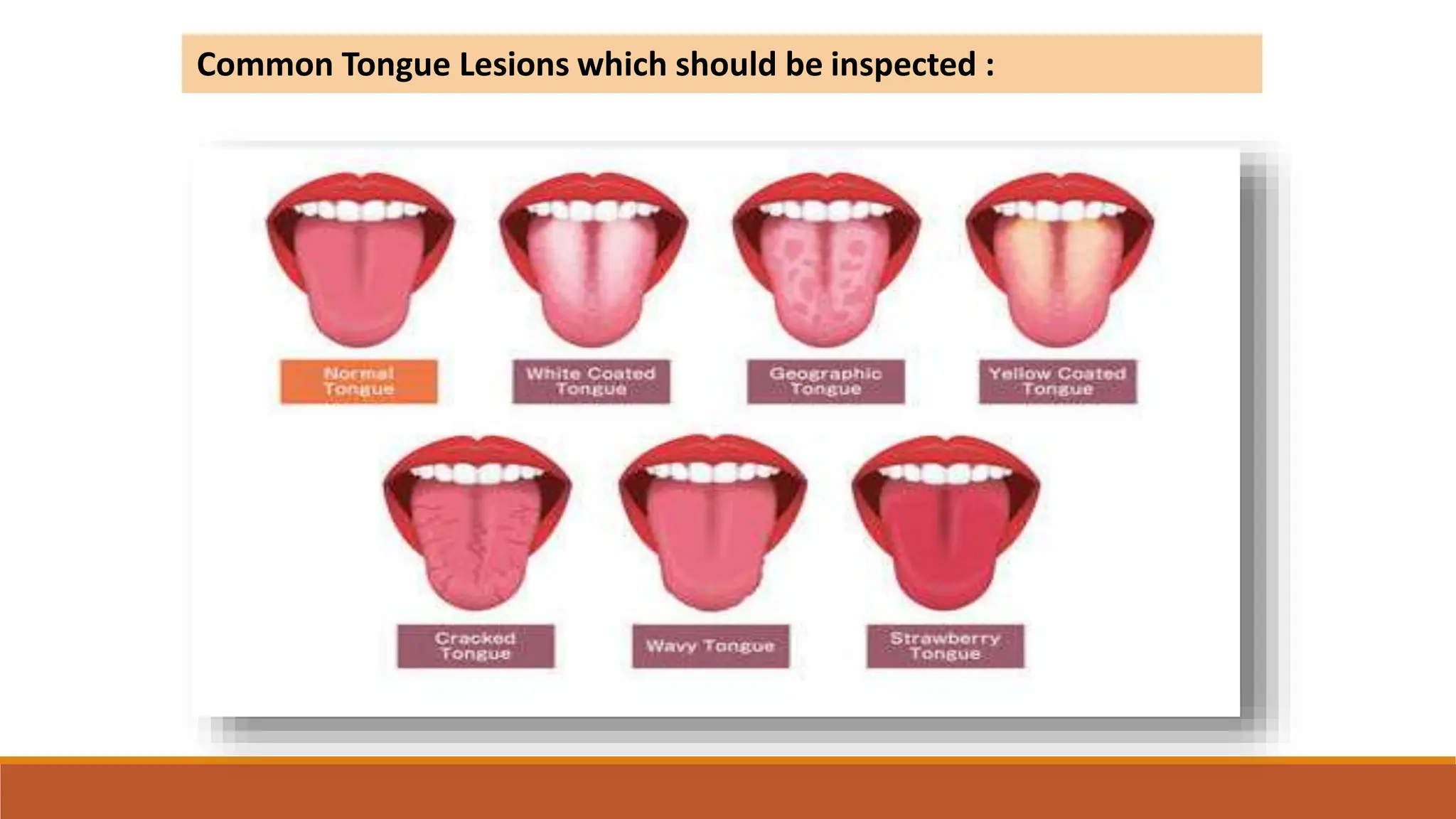 intraoral and extraoral examination.pptx