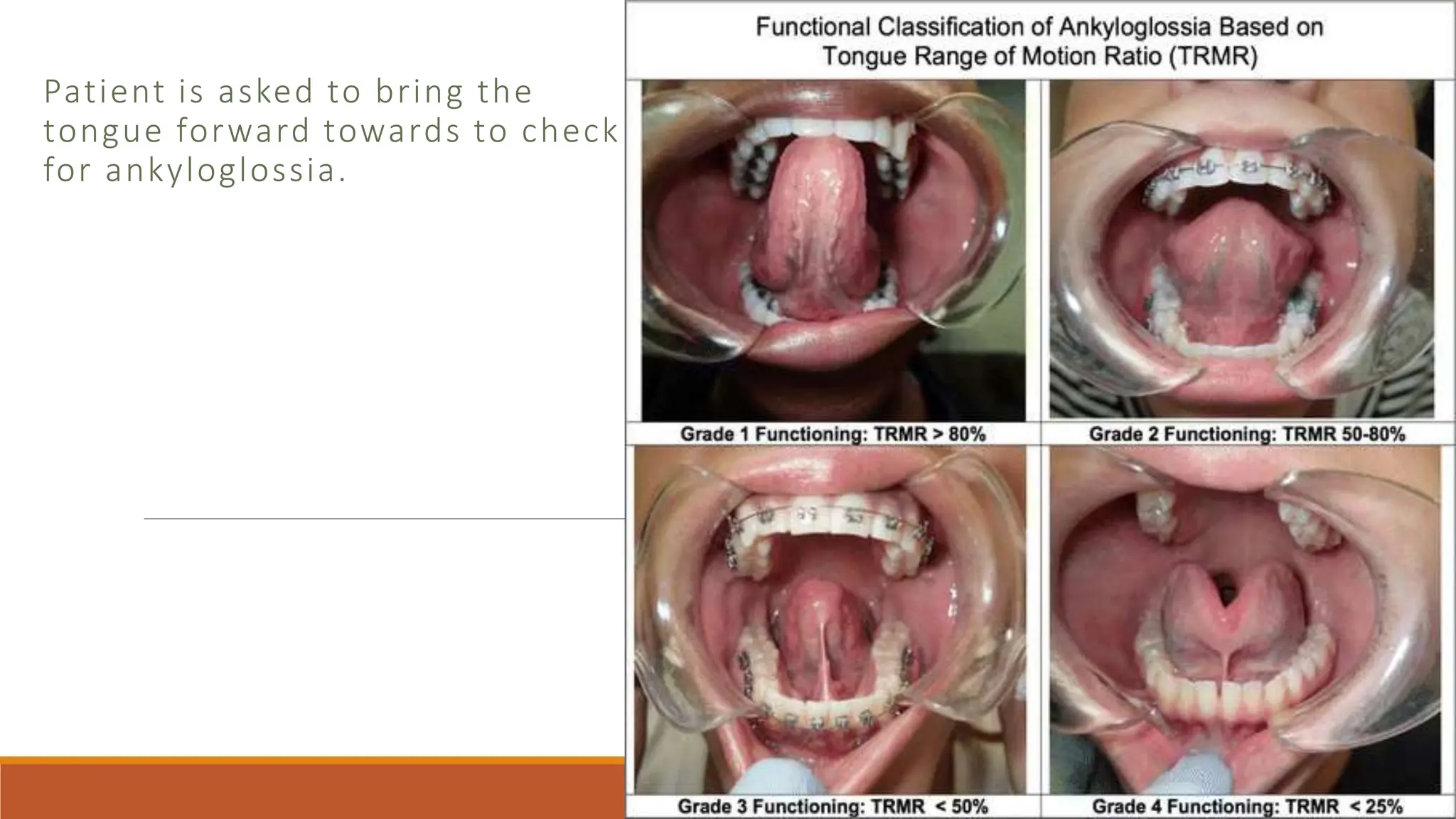 intraoral and extraoral examination.pptx