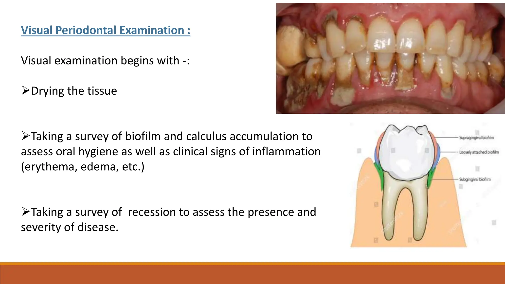 intraoral and extraoral examination.pptx