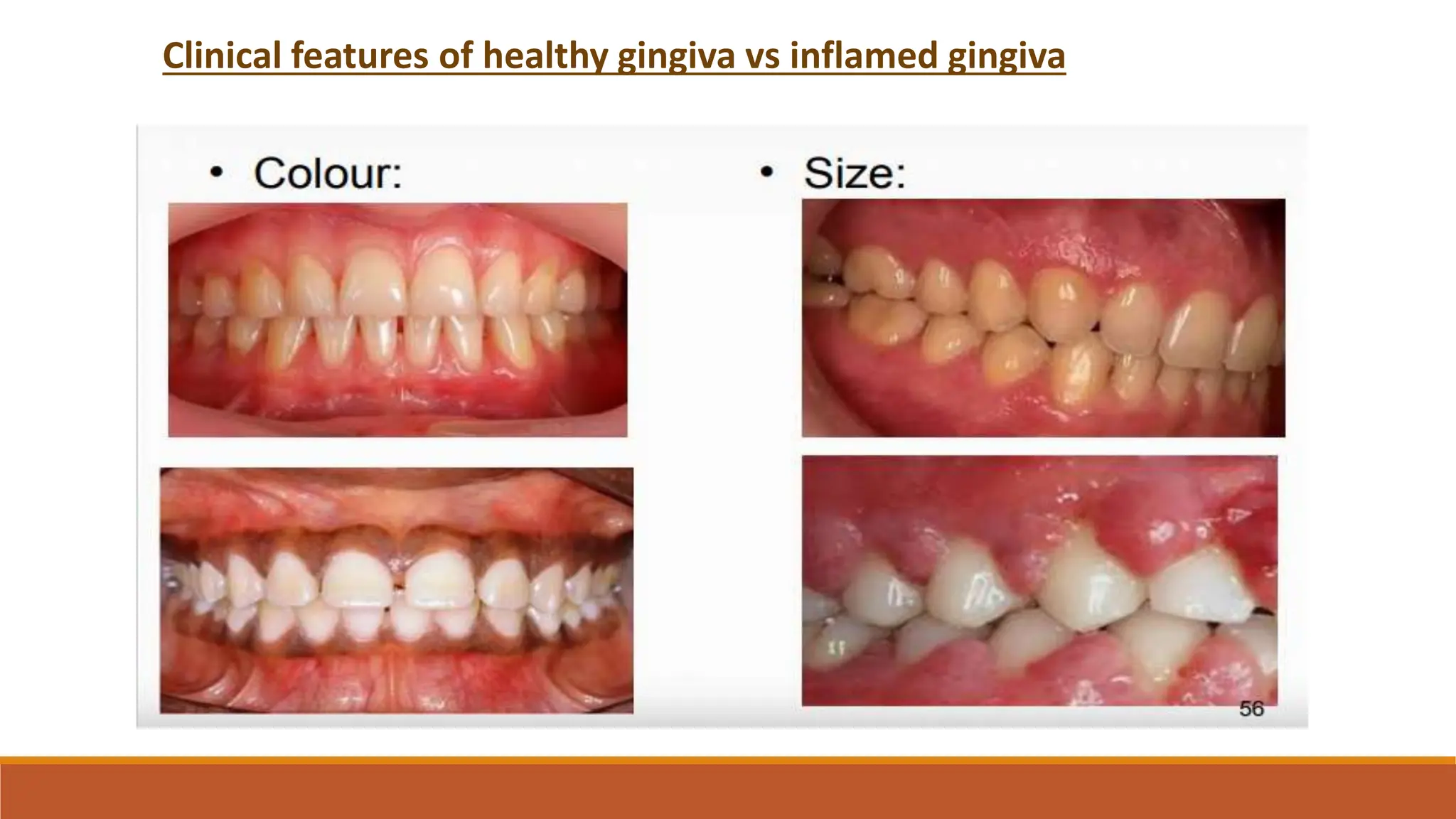 intraoral and extraoral examination.pptx