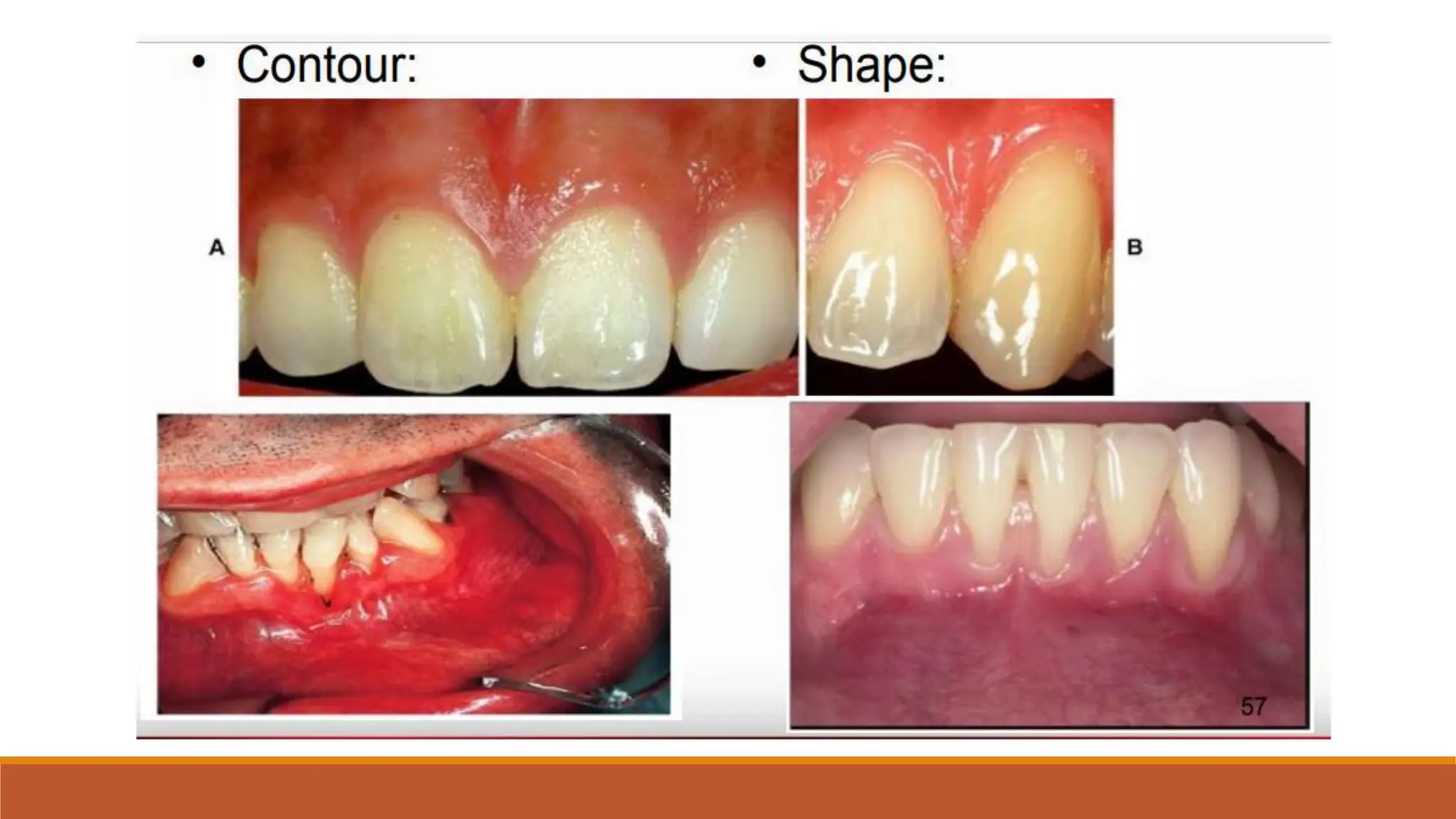 intraoral and extraoral examination.pptx