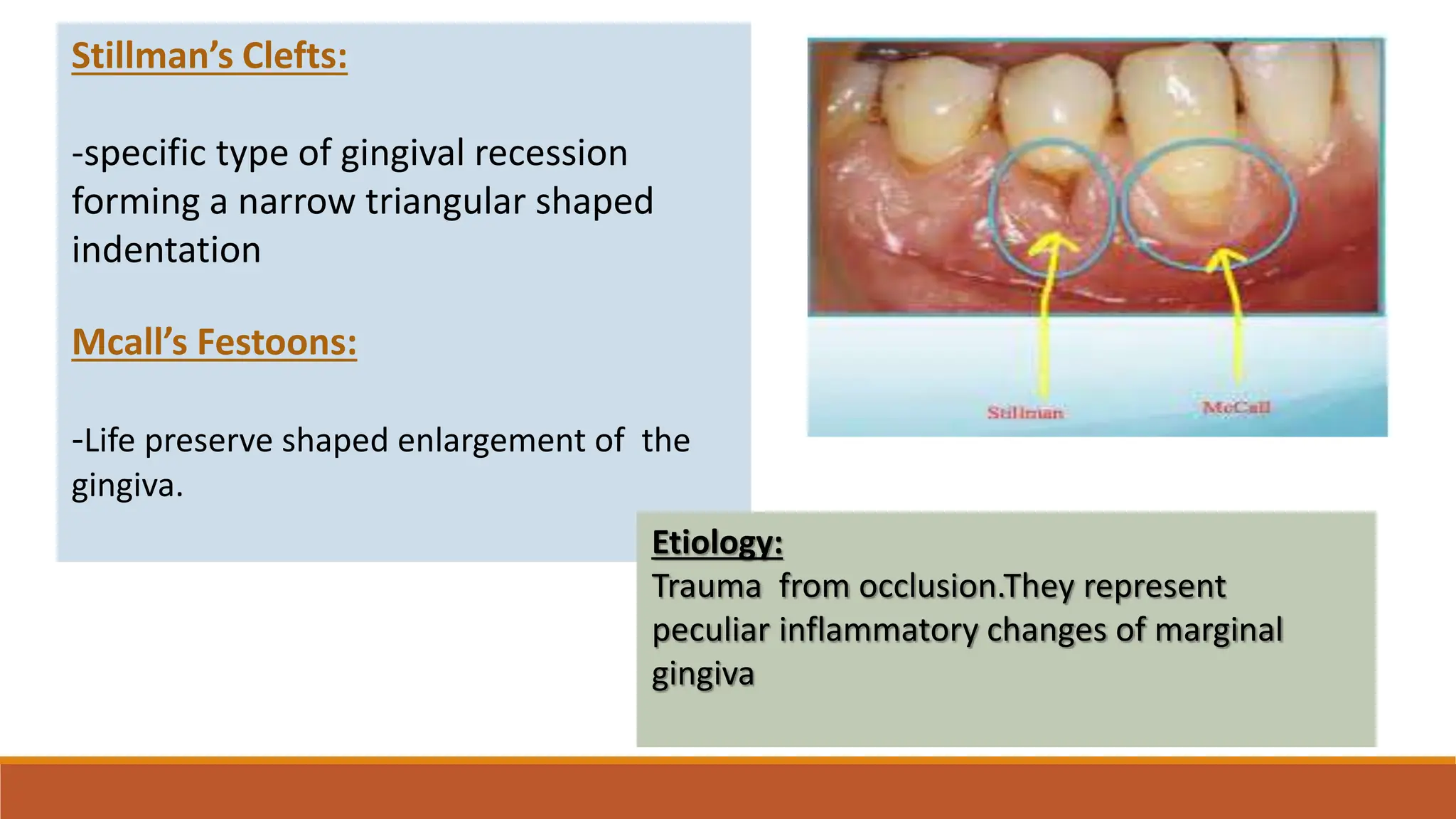 intraoral and extraoral examination.pptx