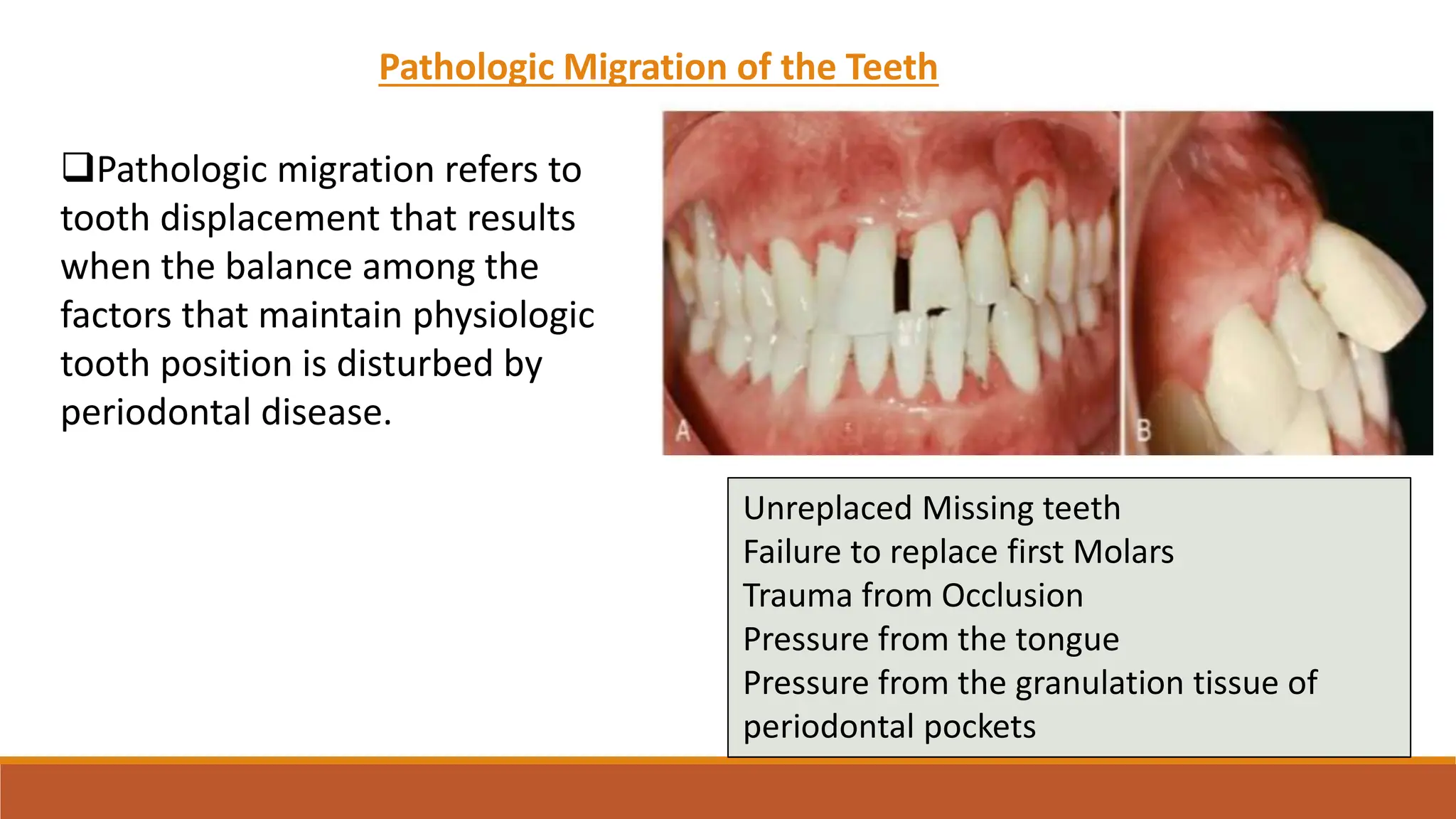 intraoral and extraoral examination.pptx