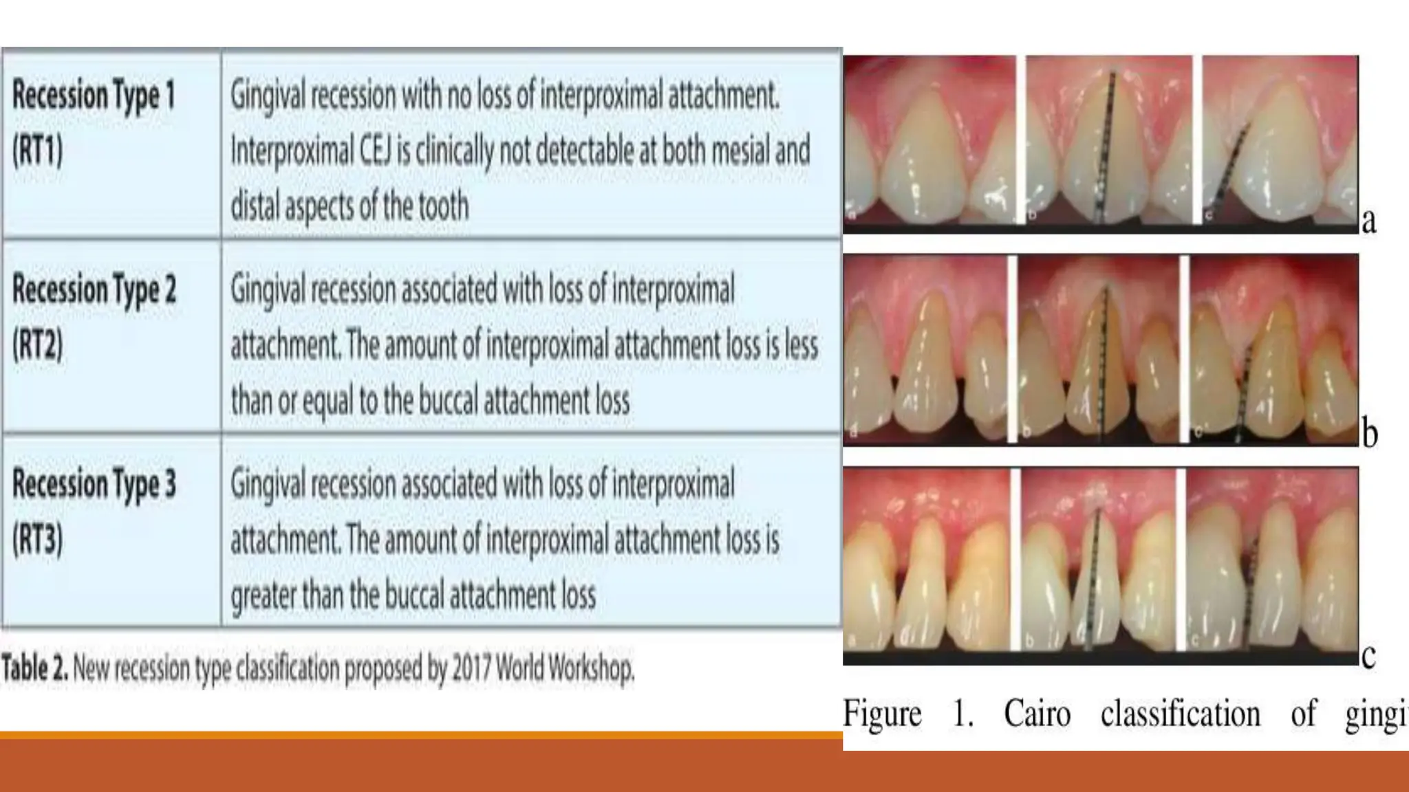 intraoral and extraoral examination.pptx