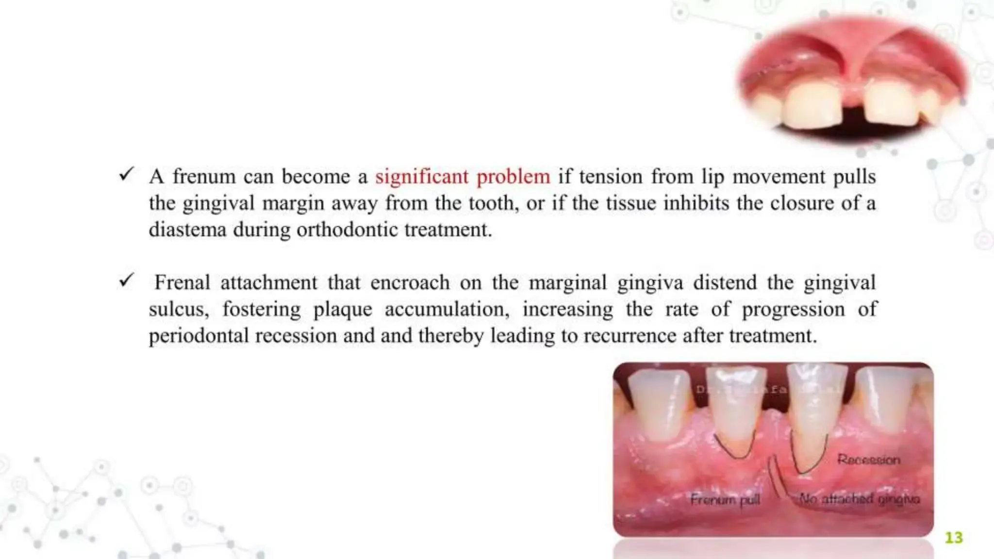intraoral and extraoral examination.pptx